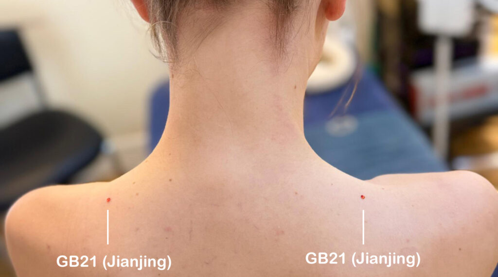 9 Acupuncture Points | Touch Tuina
